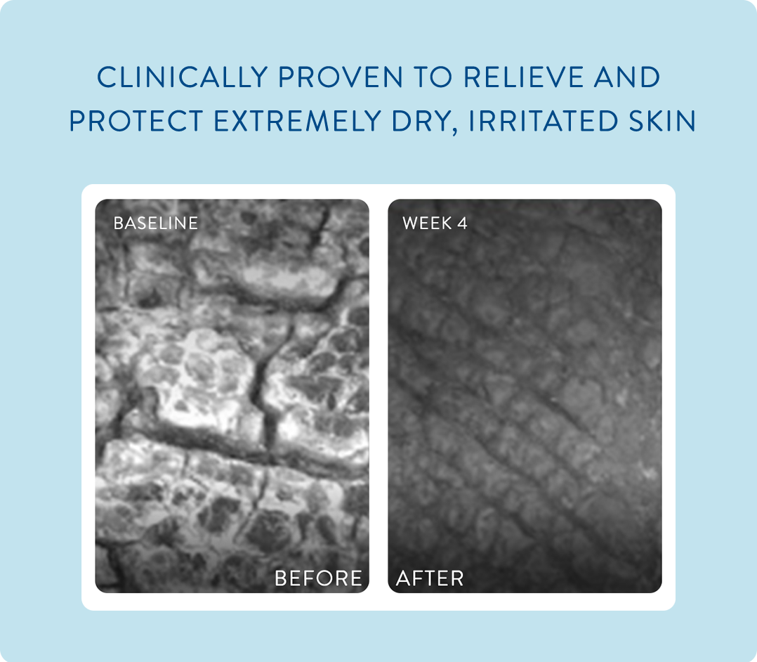 High-Active Healing Ointment | Cetaphil US