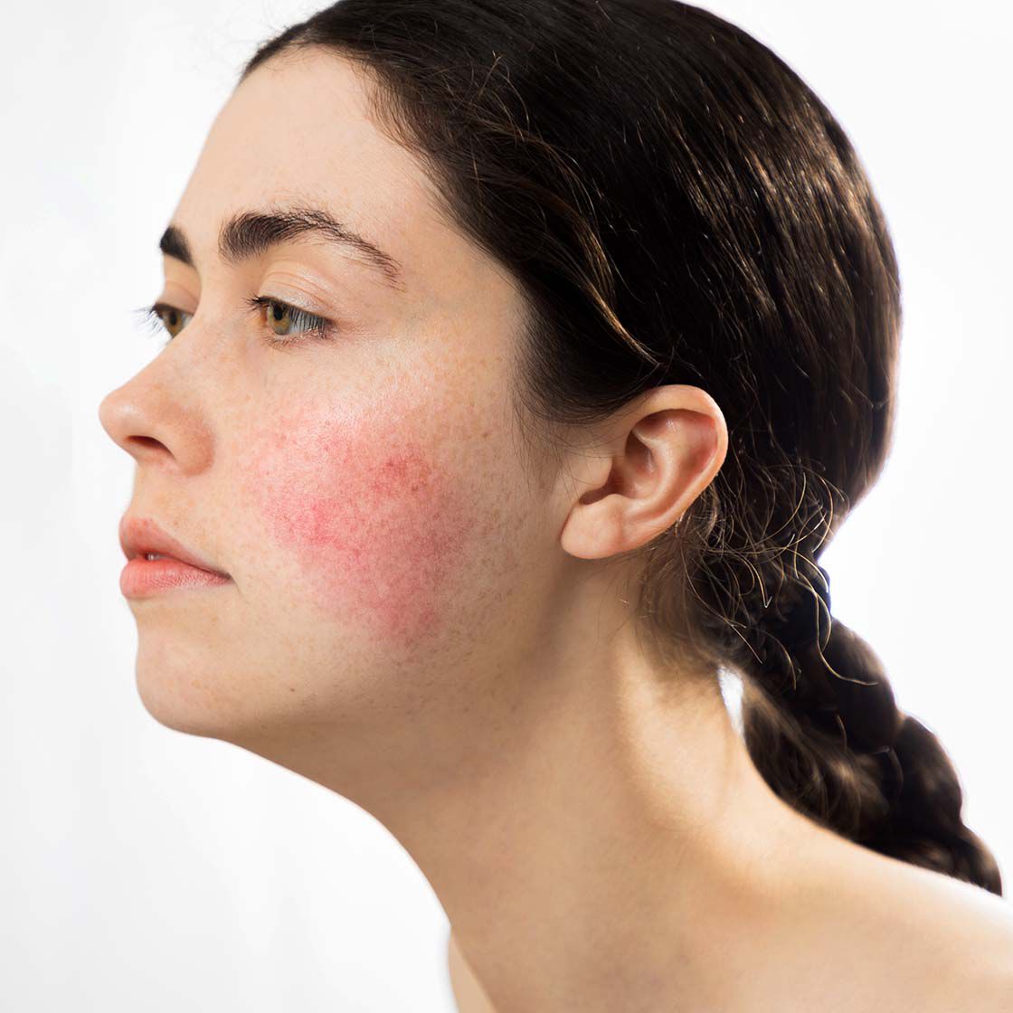 View All Articles for Skincare Tips | Cetaphil US