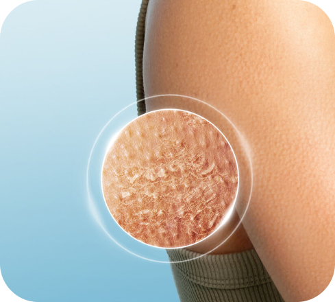 Discover All New Range of Skincare ProductsSkin Concerns' | Cetaphil US ...