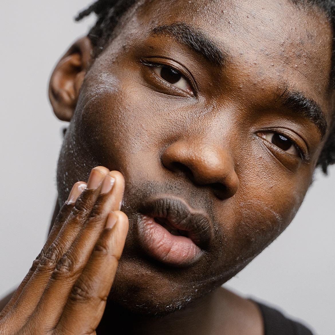 What Causes Rough And Bumpy Skin Cetaphil Us